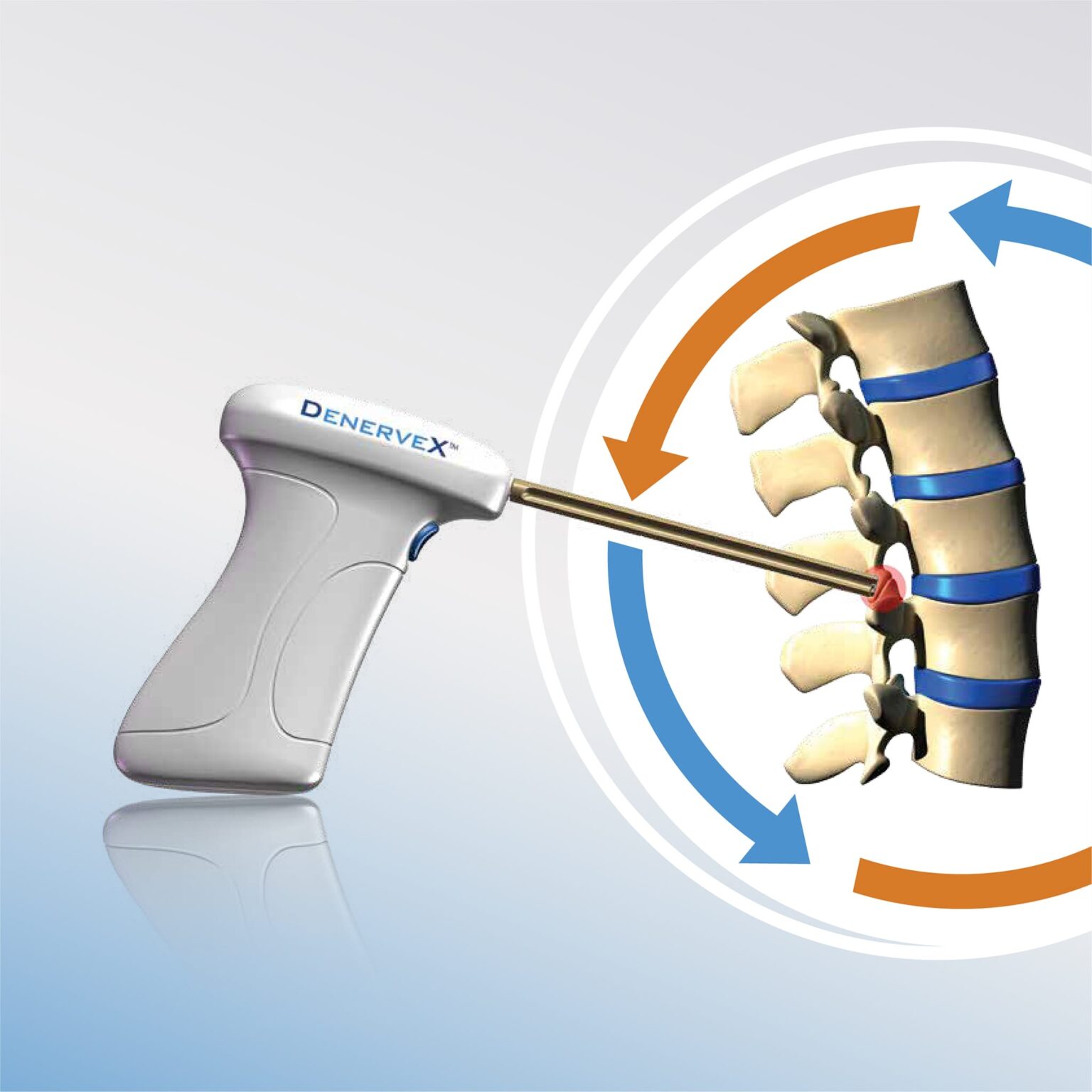 Medovex: DenerveX® | Evolutis NZ